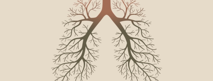 What is the Pathophysiology Lung Cancer?